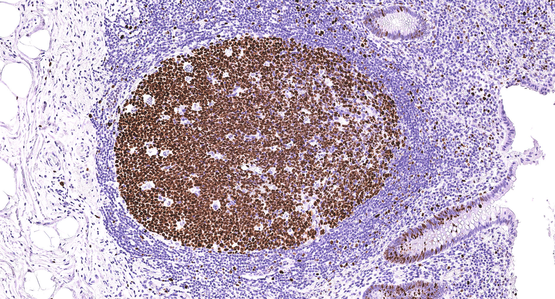 Immunohistochemistry - Comparative Pathology